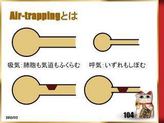 Air-Trapping の増加速度: JP-COPD